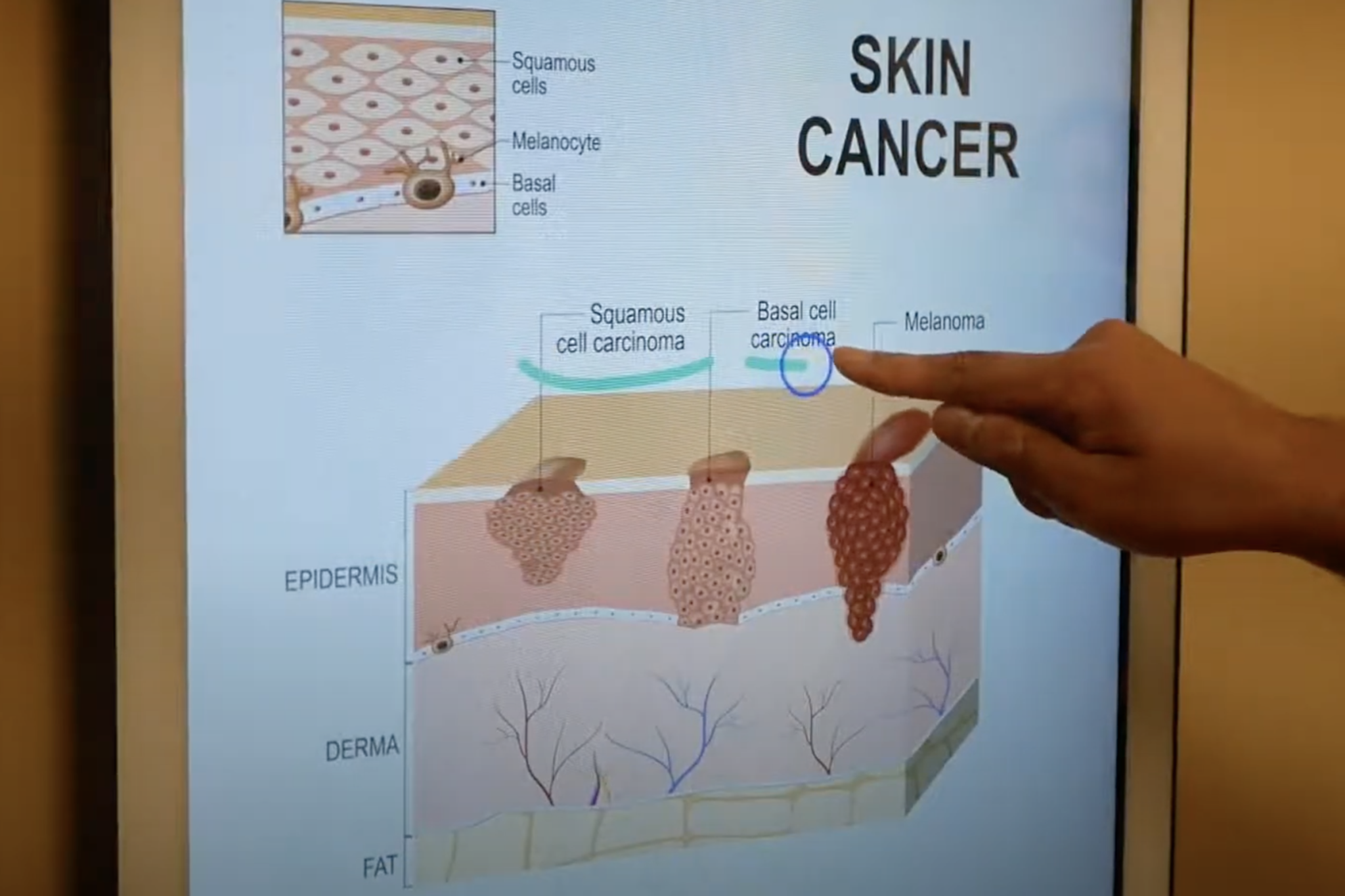 Skin Conditions & Treatments | WNY Dermatology