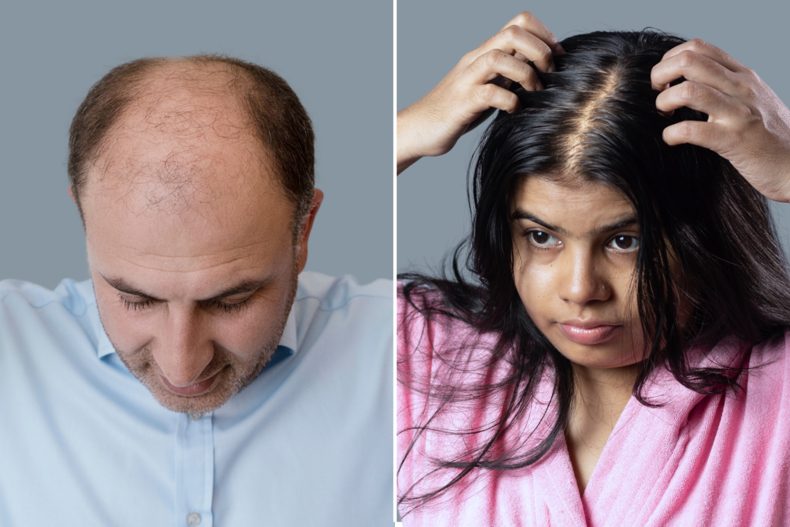Hair and Scalp Conditions | Baldness, Alopecia, Dermatitis, & More ...